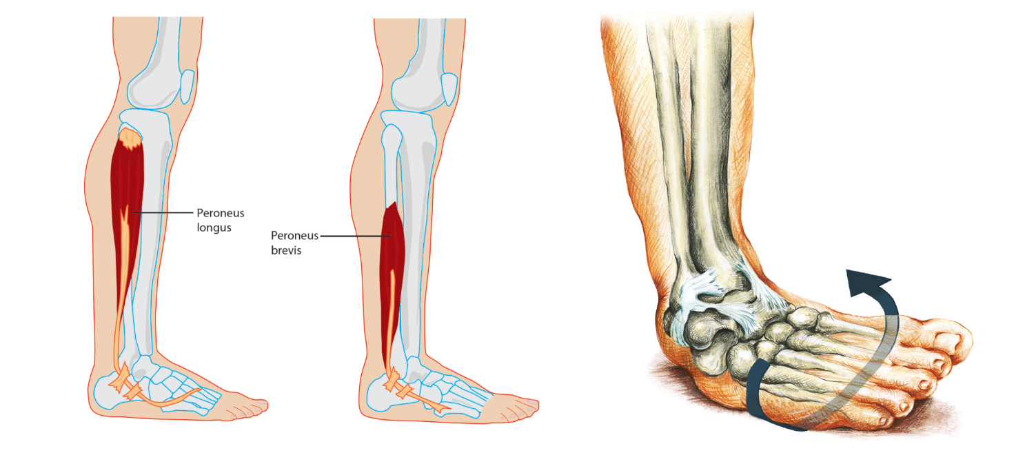 You See Me Rolling…My Ankle. Make It Stop! (Part 1/2) | Next Level ...